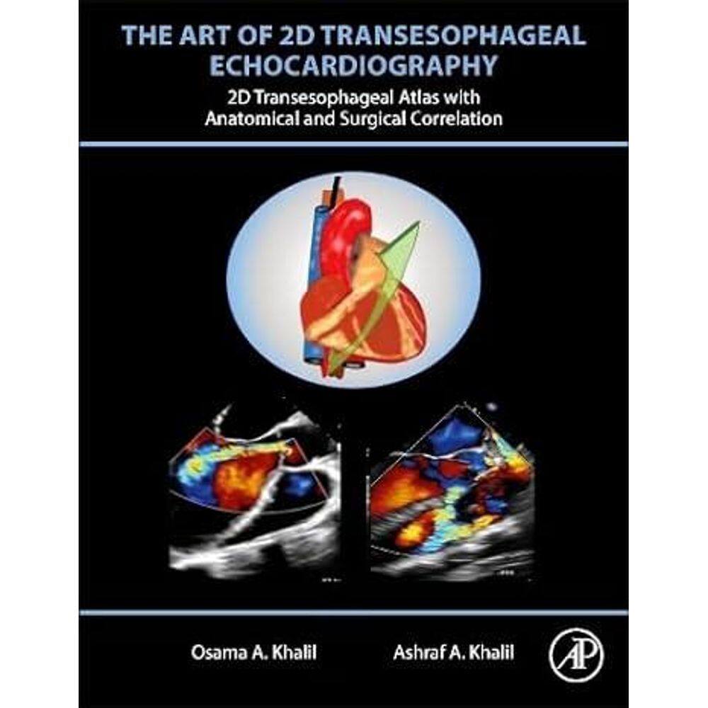 The Art Of 2D Transesophageal Echocardiography | Ponto